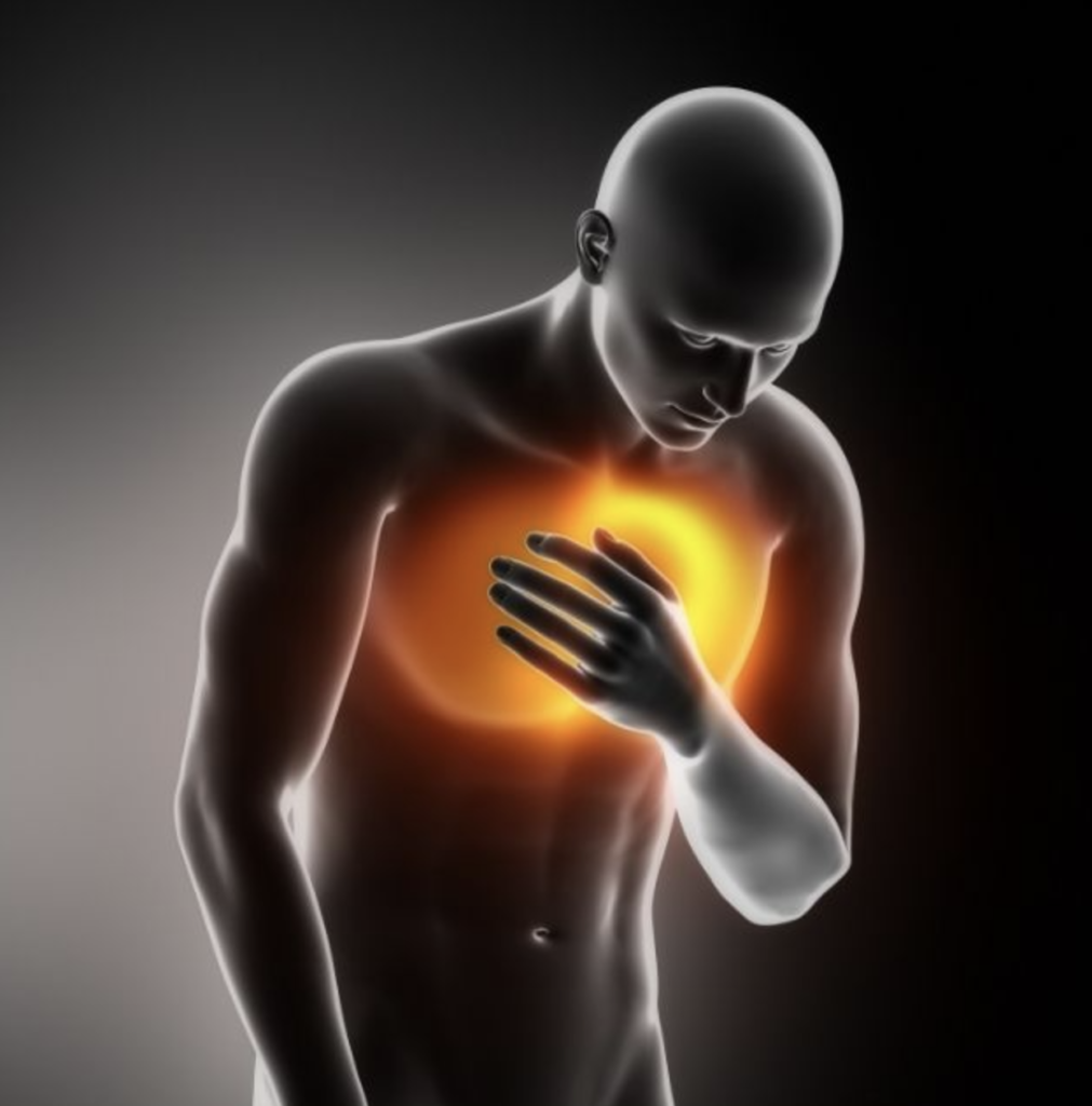 Chest Pain After A Car Accident Chaikin Sherman chest-pain-after-a-car-accident-chaikin-sherman